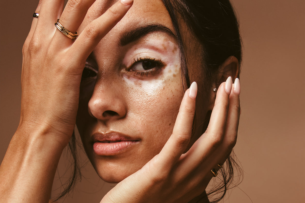 Unique Skin - Original stock photo shoot at Jacob Lund